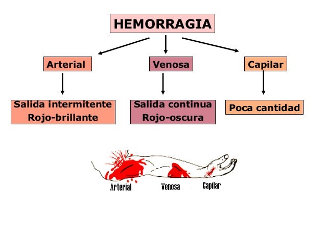 Hemorragias I