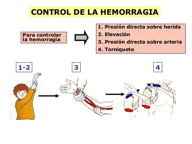 Control de hemorragias