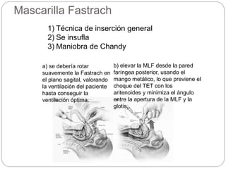 Control de las vias respiratorias | PPTX