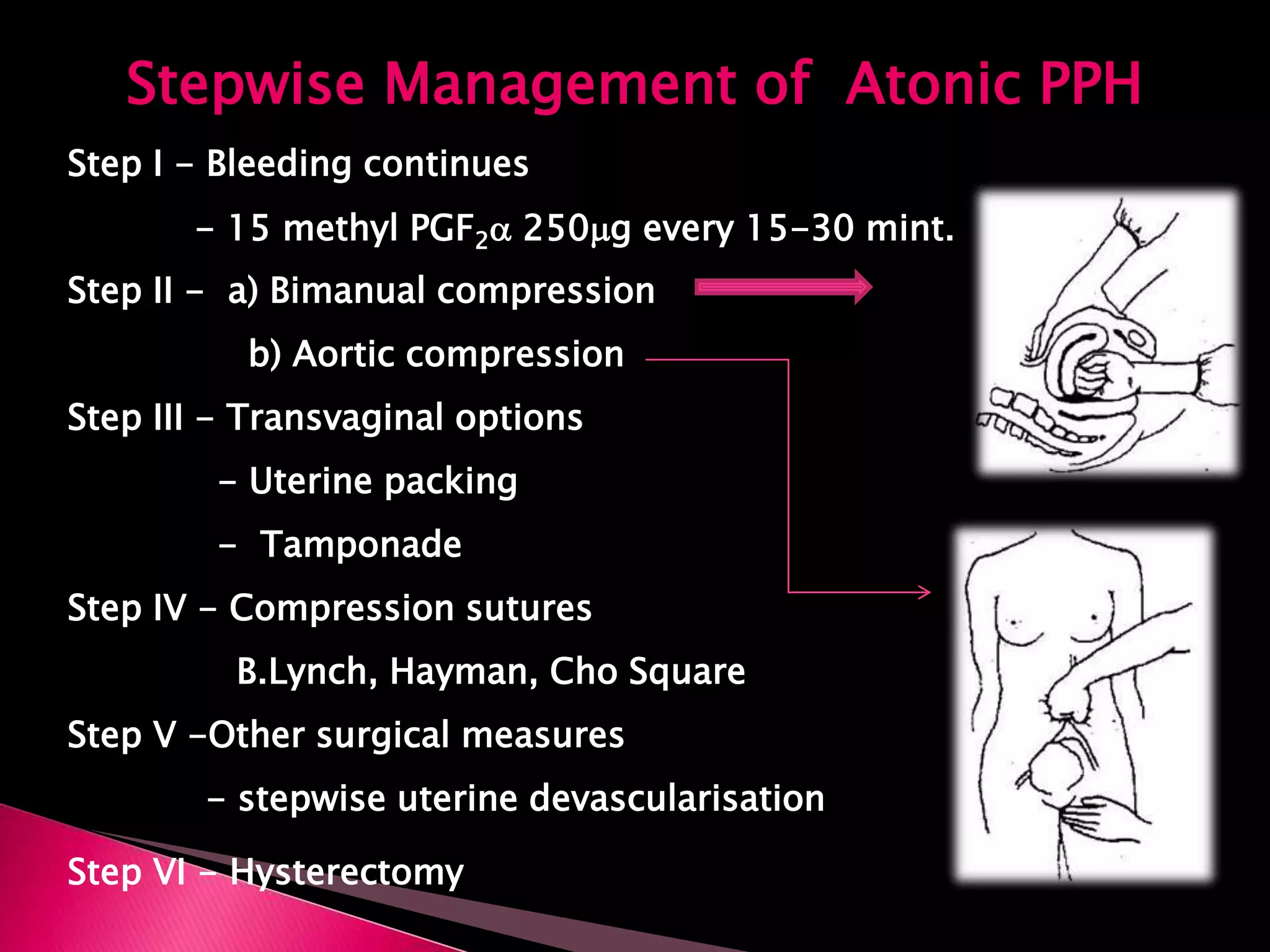 Controlling of profuse pelvic haemorrhage in obstetrics and | PPTX