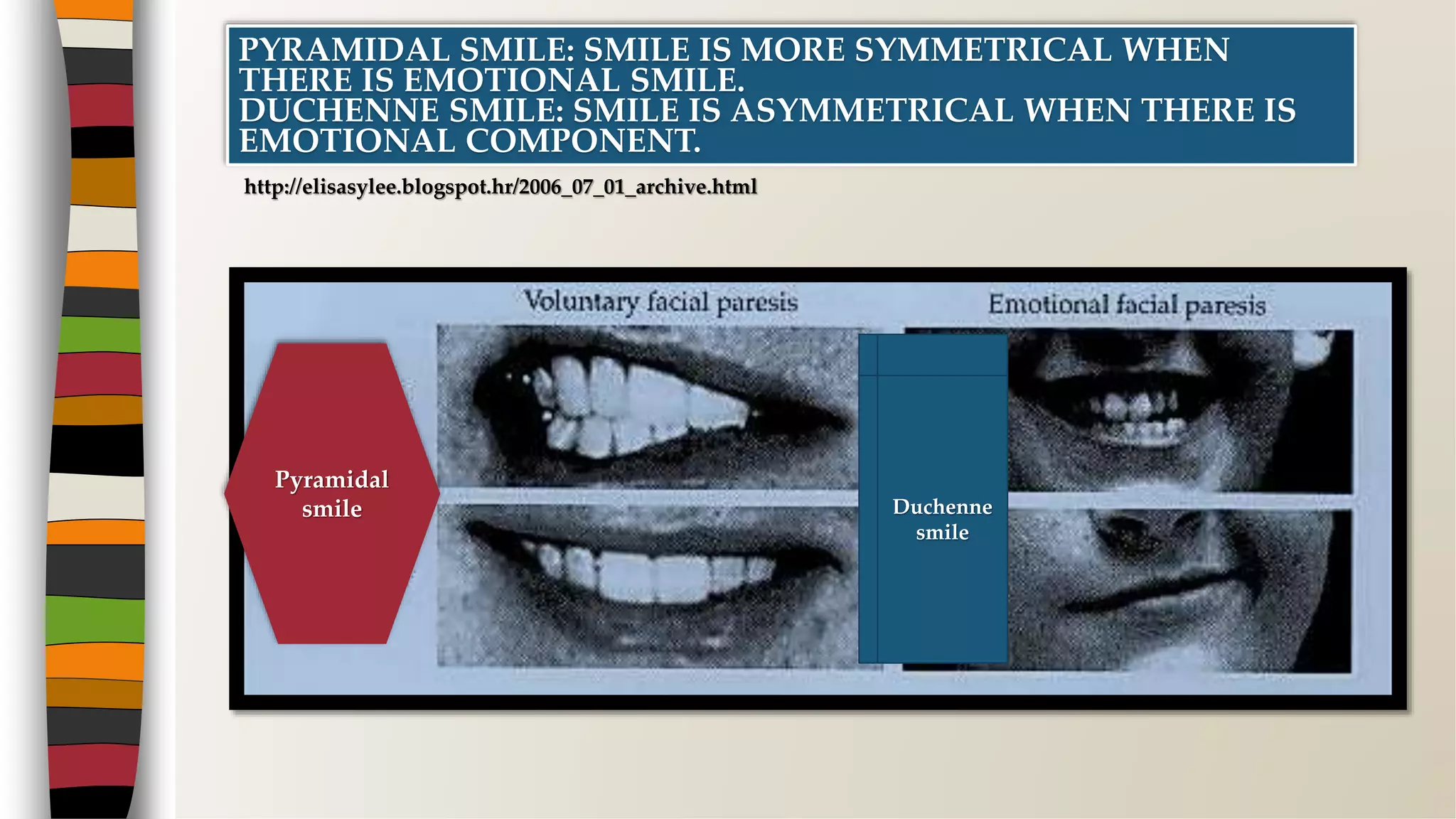 Control of facial expressions | PPSX