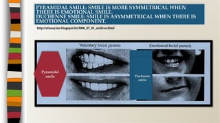 Control of facial expressions | PPSX