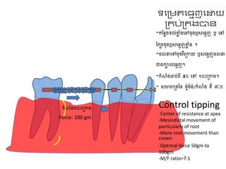 Control tipping | PPT