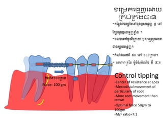 Control tipping | PPT