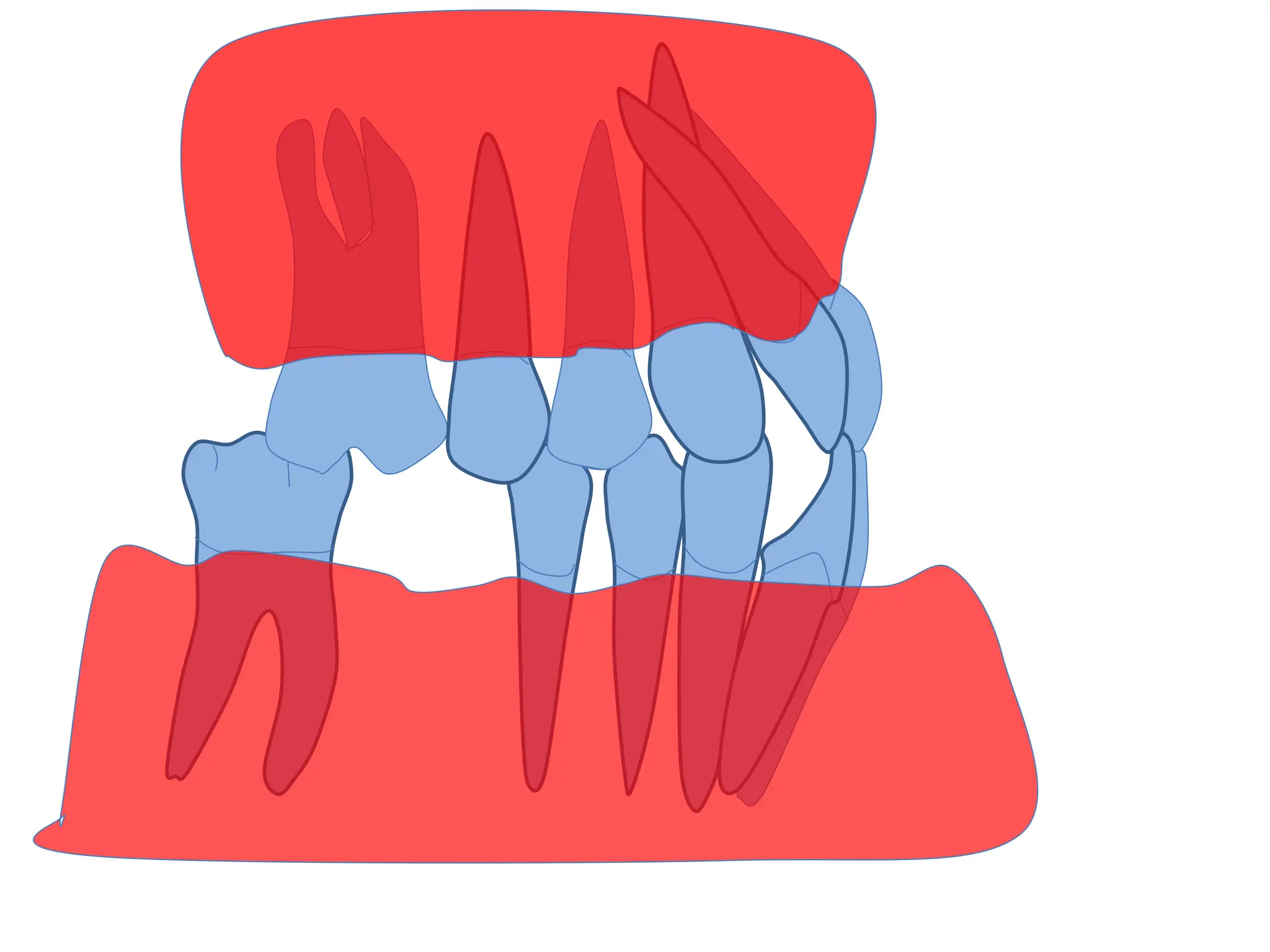 Control tipping.pptx