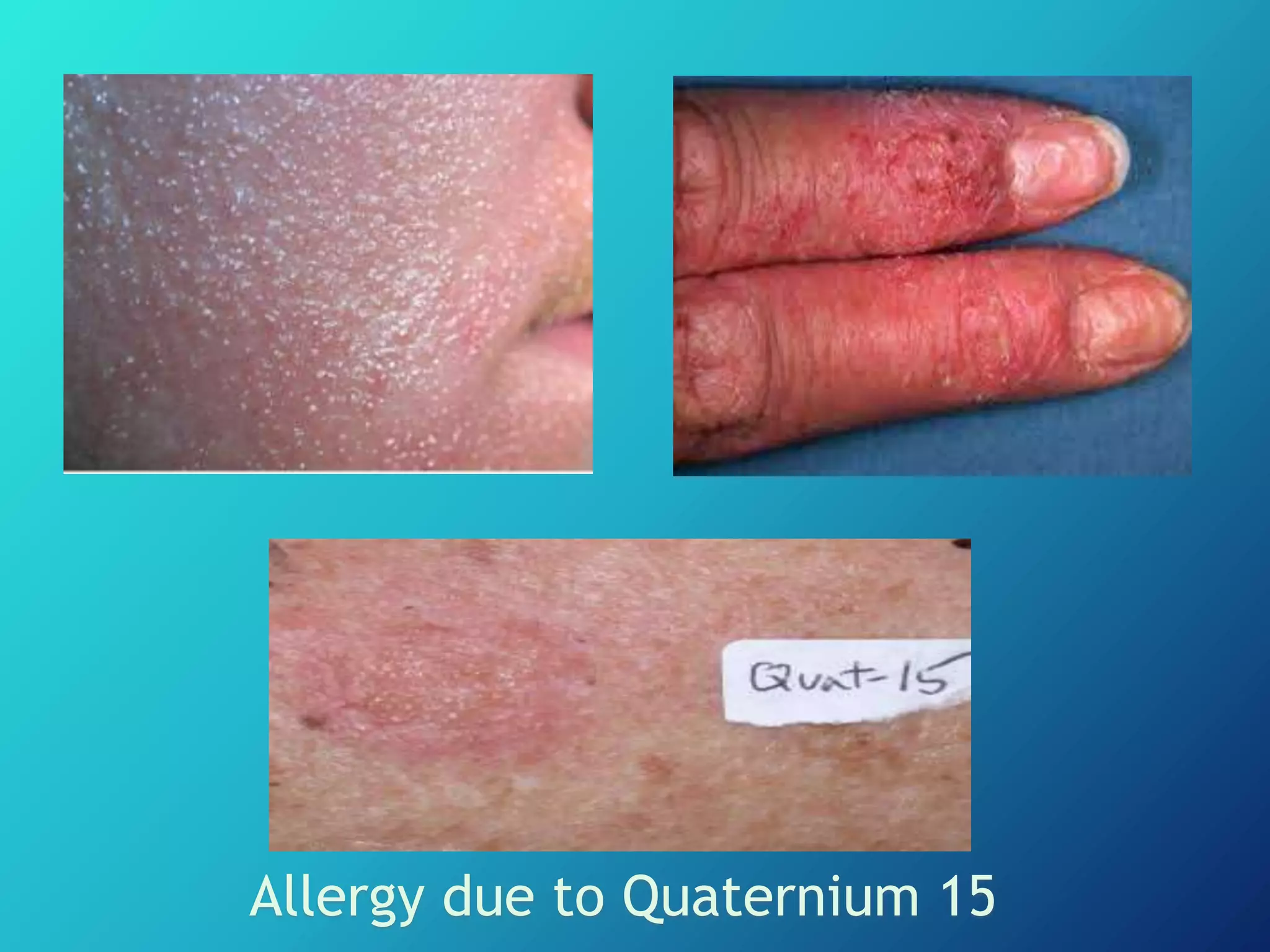 Controversial ingredients of cosmetics | PPTX