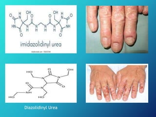 Controversial ingredients of cosmetics | PPTX