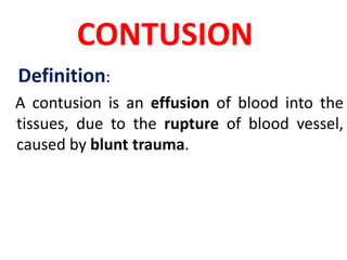 Contusion - A physical injury. It happen by any road accident, falling ...