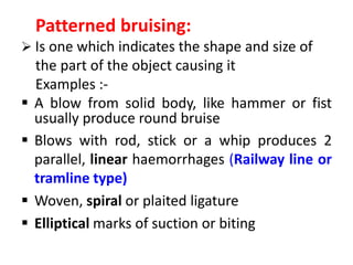 Contusion - A physical injury. It happen by any road accident, falling ...
