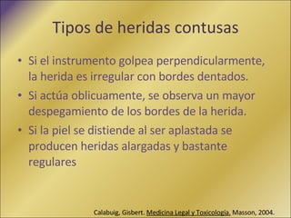 Contusiones | PPT