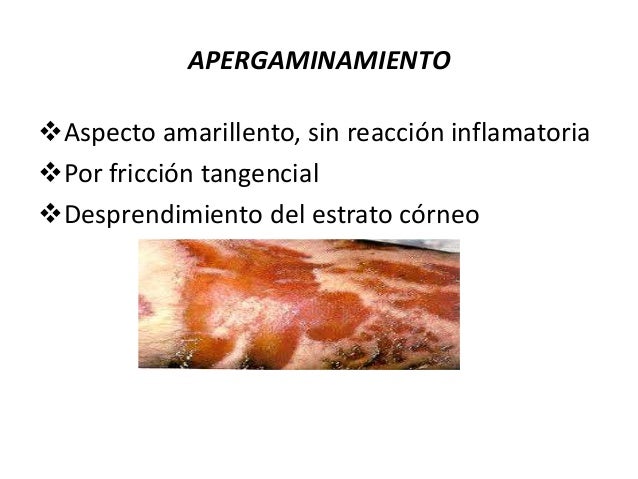 Lesiones Y Contusiones