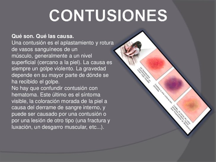 Contusiones,luxaciones y fracturas