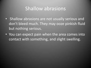 Contusions & abrasions | PPTX