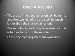 Contusions & abrasions | PPTX