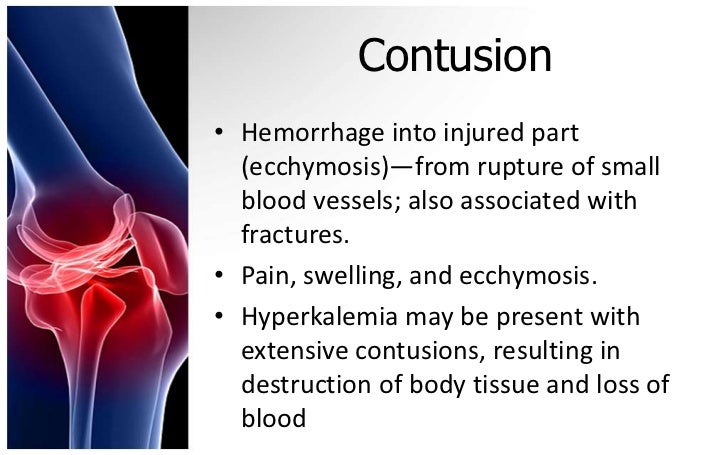 Contusions, strains and sprains