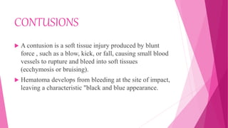 Contusion,strain,sprains.pptx