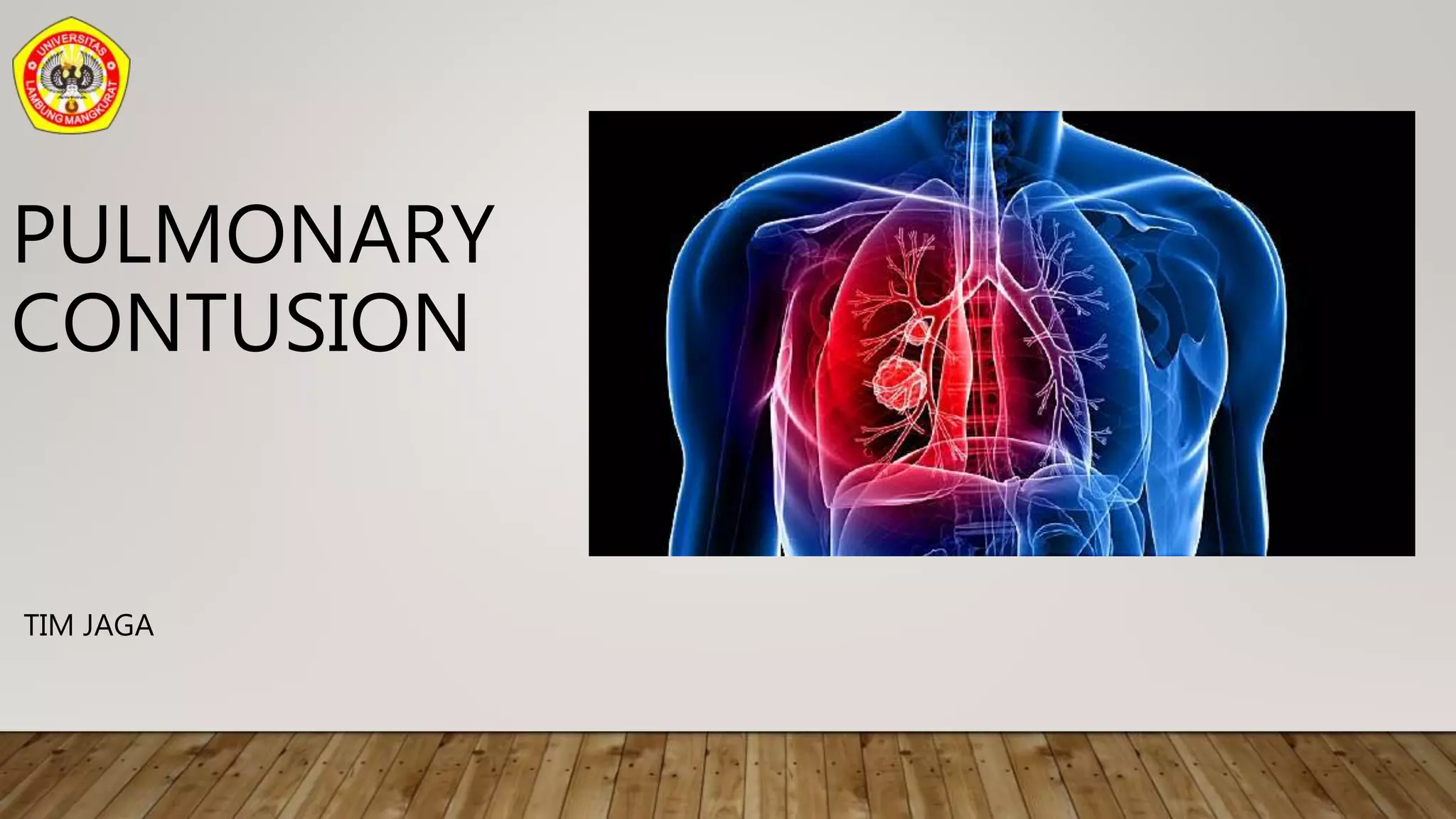 pulmonary contusion | PPTX