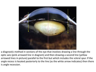 Contutional injuries | PPTX