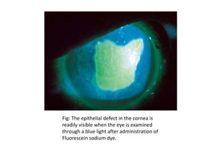 Contutional injuries | PPTX