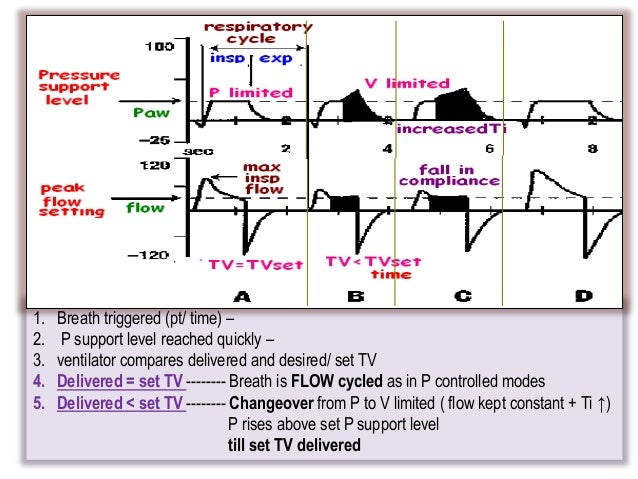 Conv. ventilation physi