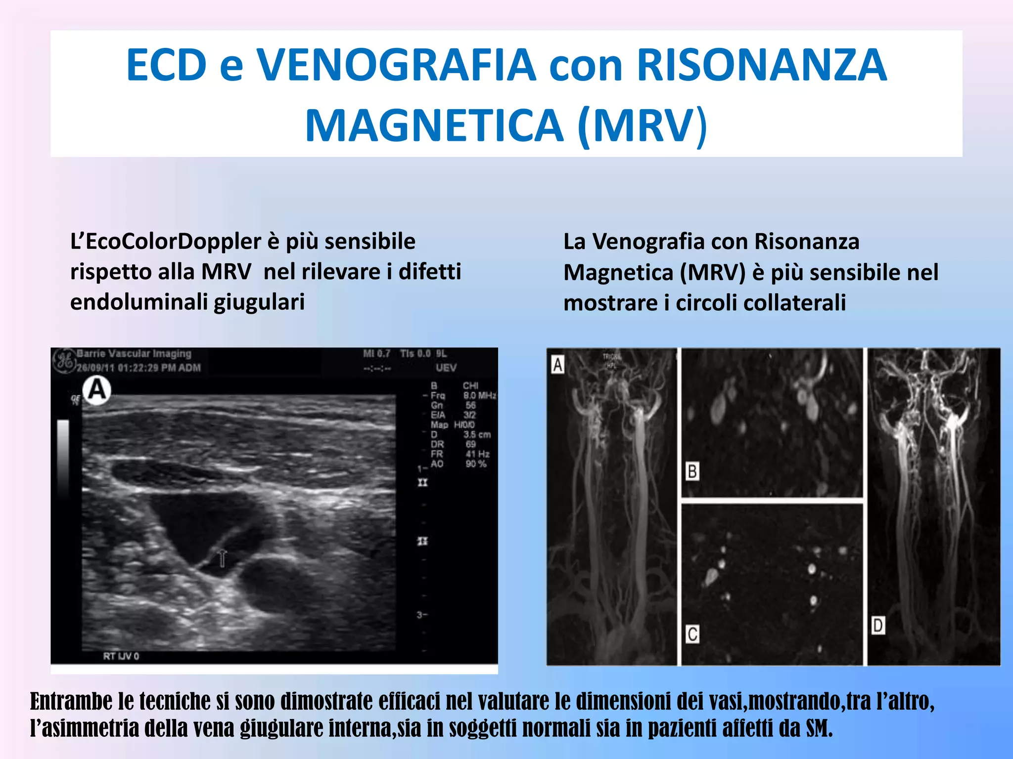 BMC Neurology BioMed Central | PDF | Ear, Nose and Throat Conditions ...