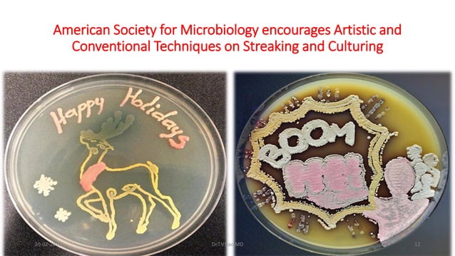 CONVENTIONAL MICROBIOLOGICAL TECHNIQUES | PDF | Infectious Diseases ...