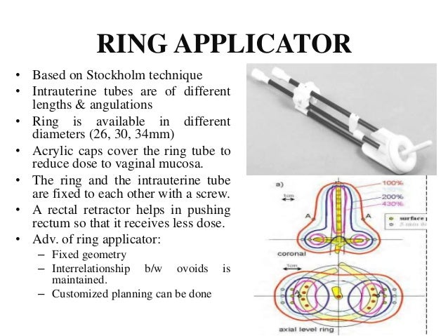 Conventional Brachytherapy in carcinoma cervix
