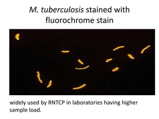 Conventional lab diagnosis of tb | PPTX