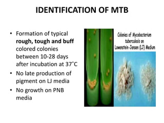Conventional lab diagnosis of tb | PPTX