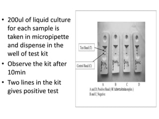 Conventional lab diagnosis of tb | PPTX