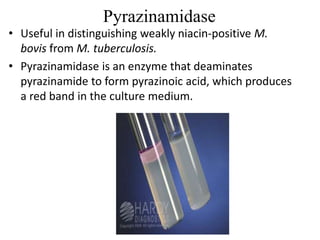 Conventional lab diagnosis of tb | PPTX