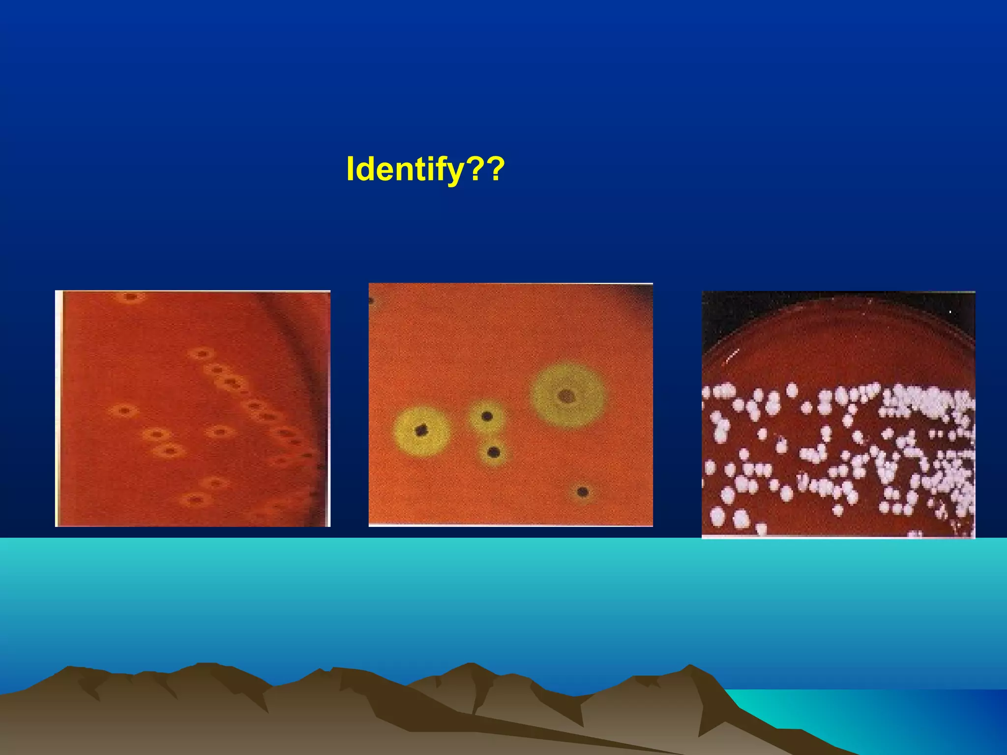 Conventional methods for bacterial identification | PPT