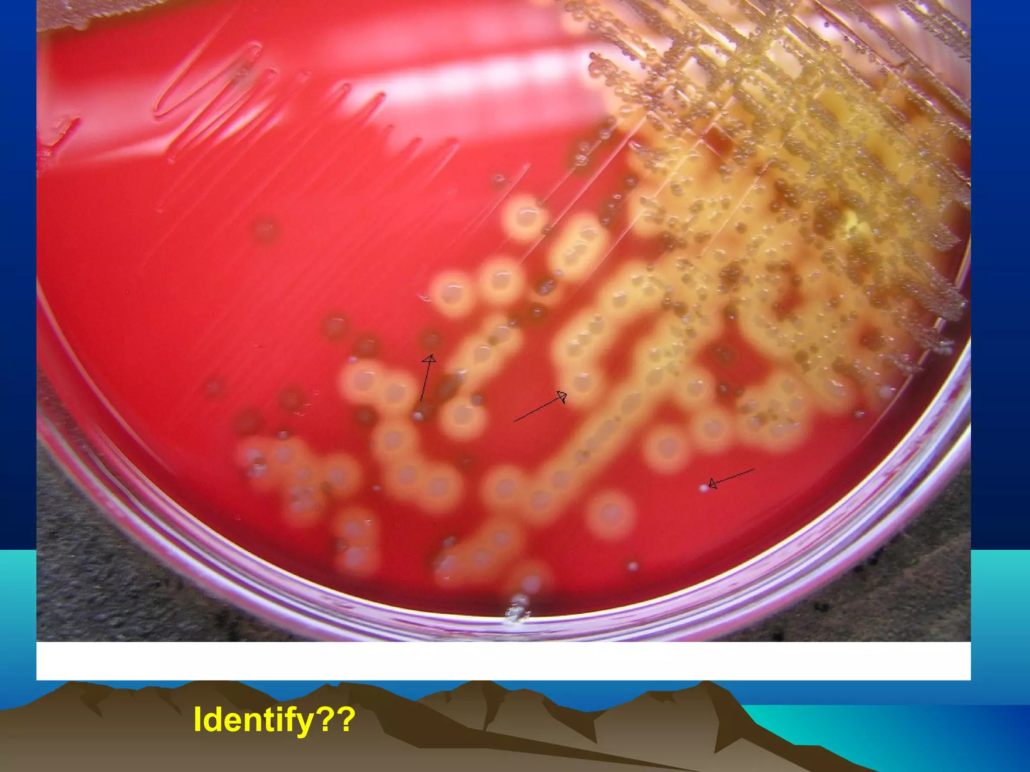 Conventional methods for bacterial identification | PPT