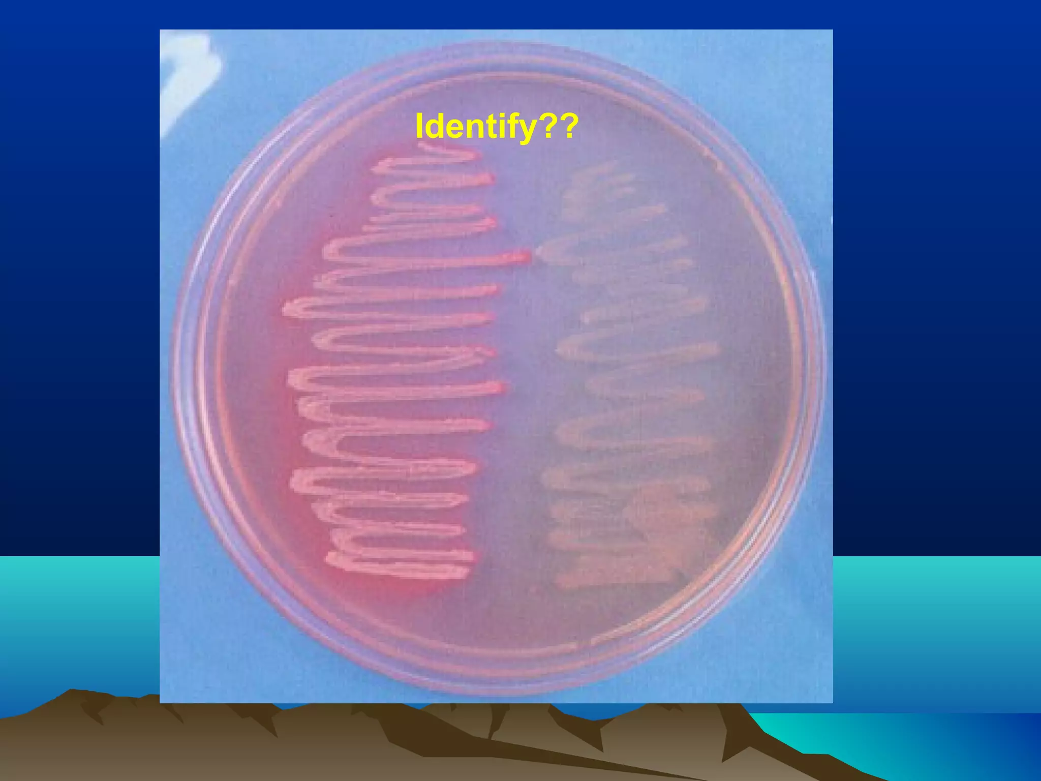 Conventional methods for bacterial identification | PPT