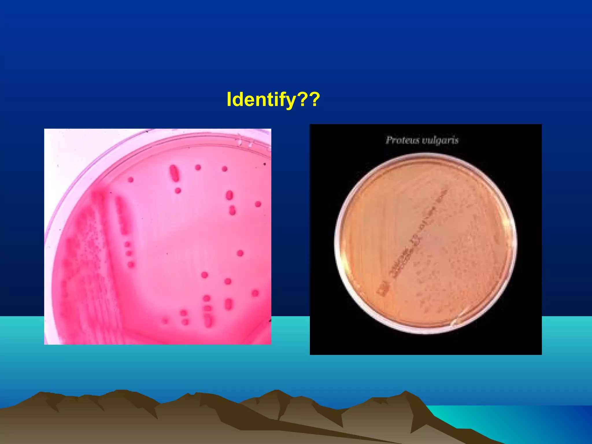Conventional methods for bacterial identification | PPT
