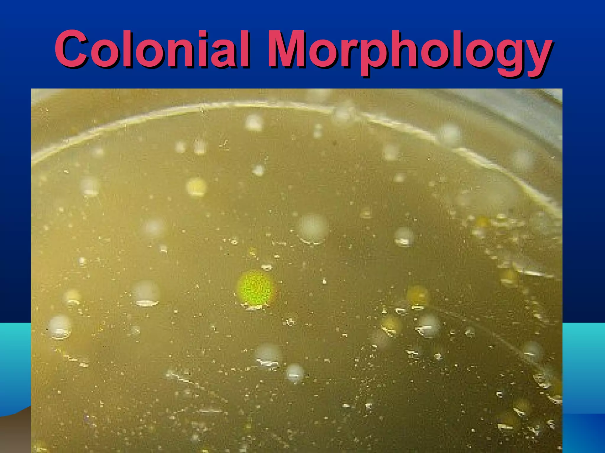Conventional methods for bacterial identification | PPT