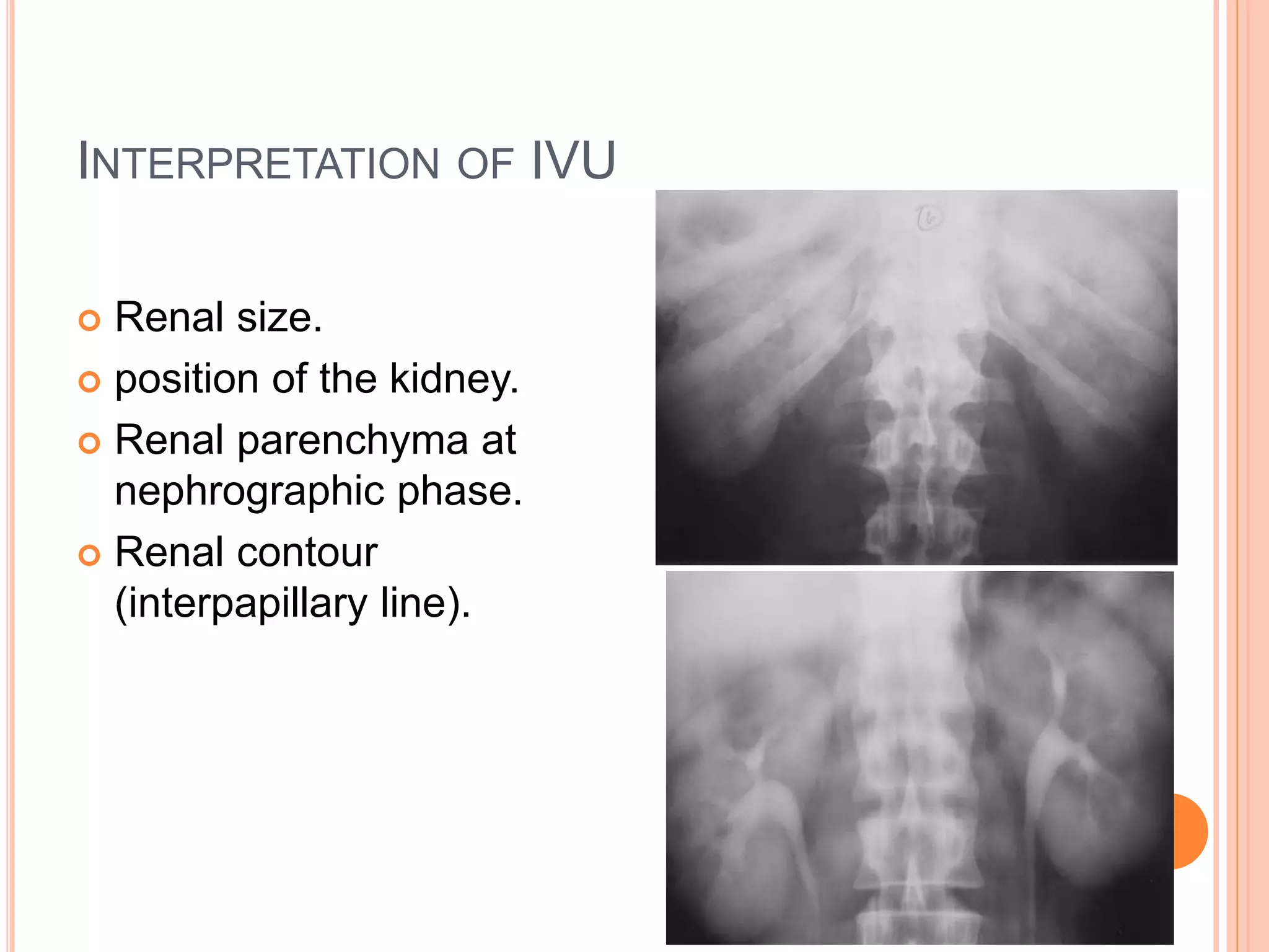 Conventional nephroradiology | PPTX