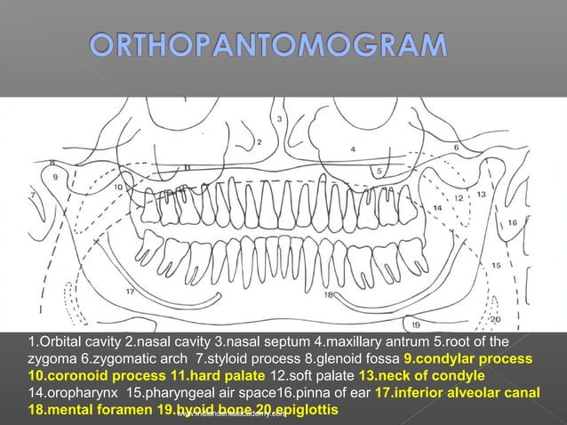 Conventional omfs radiology / dental implant courses | PPT