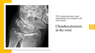 Conventional radiography in Rheumatic diseases | PPTX