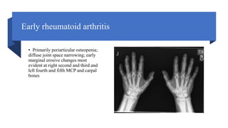 Conventional radiography in Rheumatic diseases | PPTX
