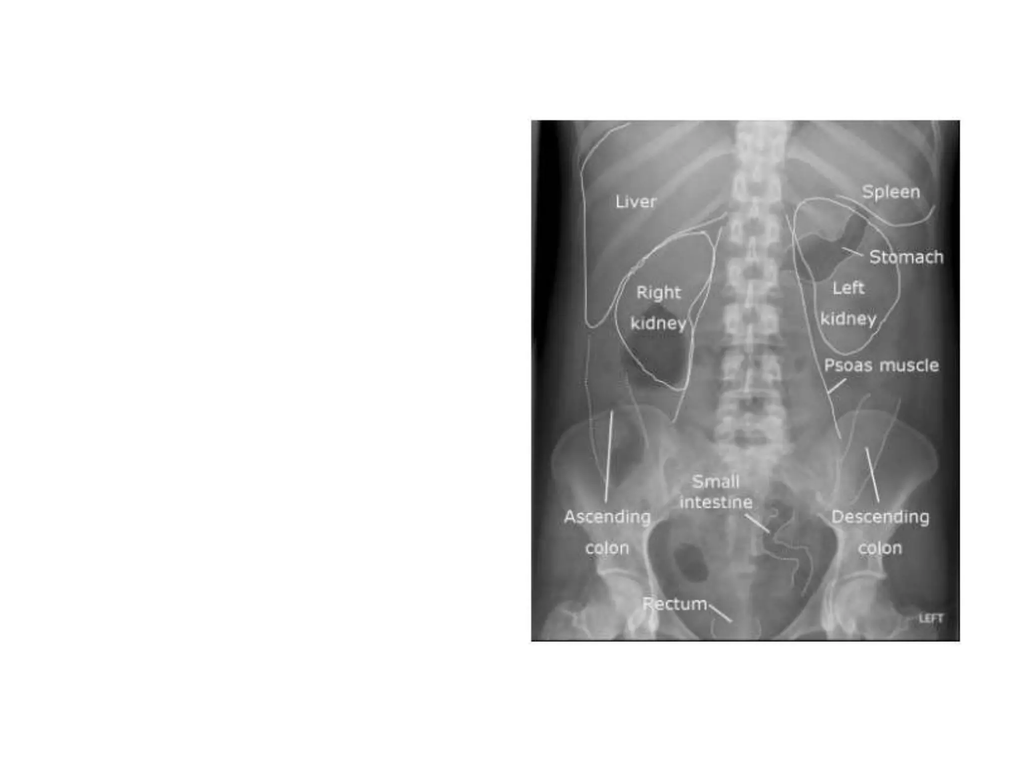 Conventional Radiology In Urology.pptx