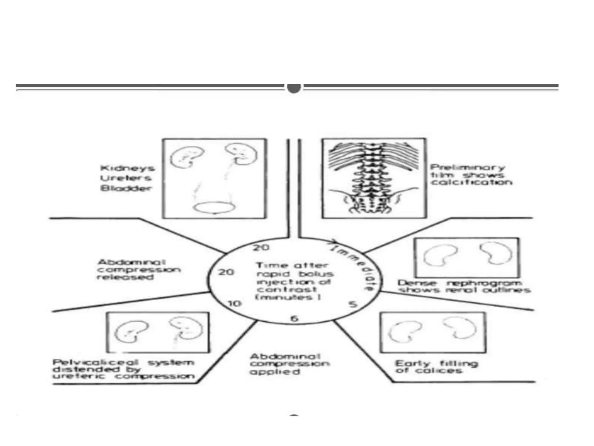 Conventional Radiology In Urology.pptx