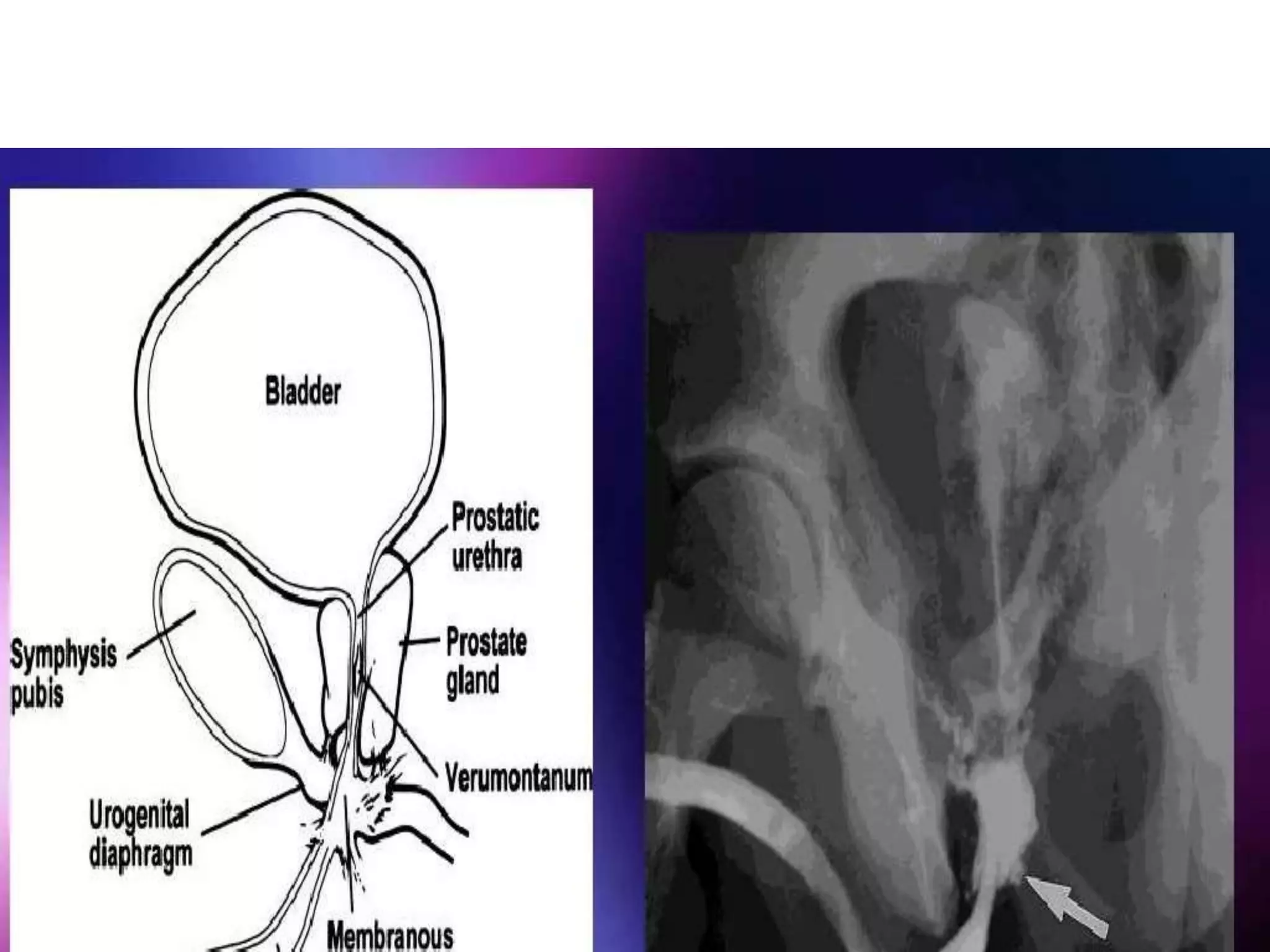 Conventional Radiology In Urology.pptx