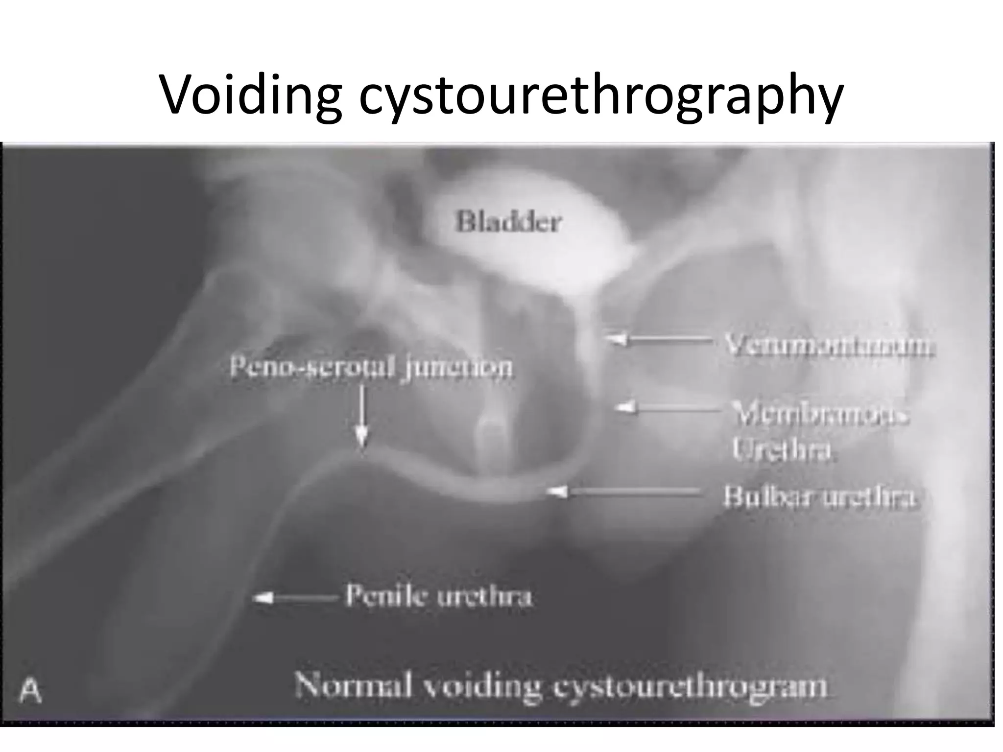 Conventional Radiology In Urology.pptx