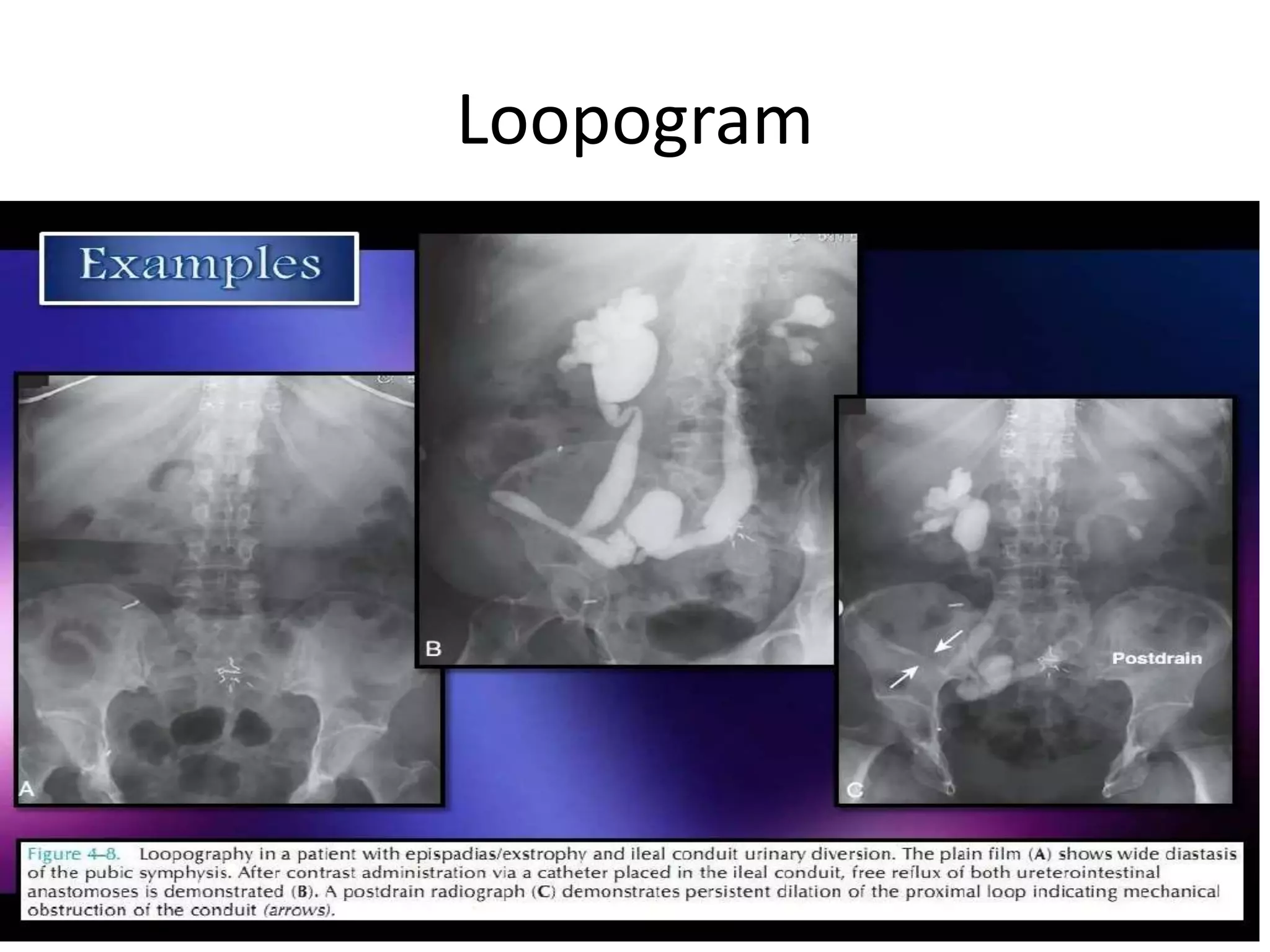 Conventional Radiology In Urology.pptx