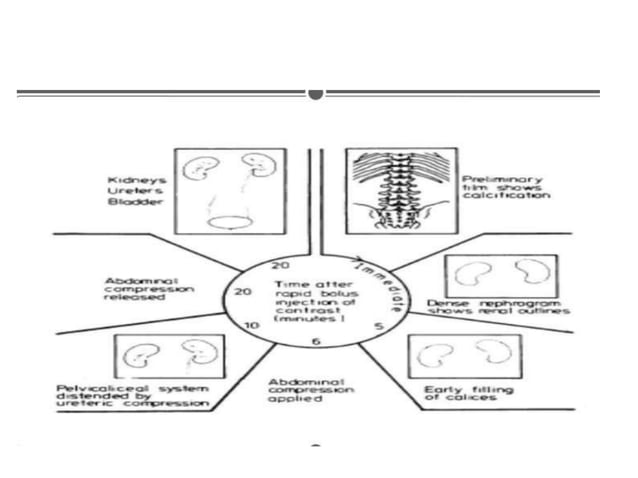 Conventional Radiology In Urology.pptx | Digestive Disorders | Diseases ...
