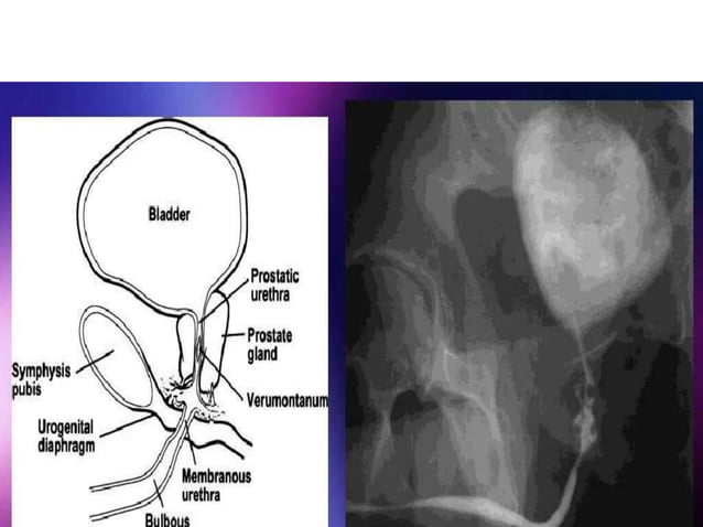 Conventional Radiology In Urology.pptx | Digestive Disorders | Diseases ...