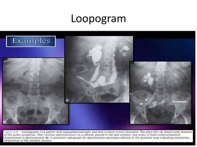 Conventional Radiology In Urology.pptx | Digestive Disorders | Diseases ...