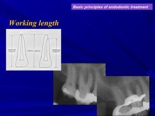 Conventional RCT | PPT