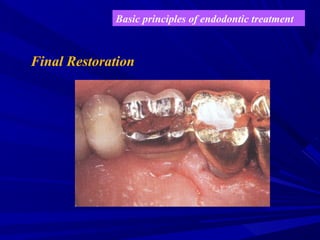 Conventional RCT | PPT
